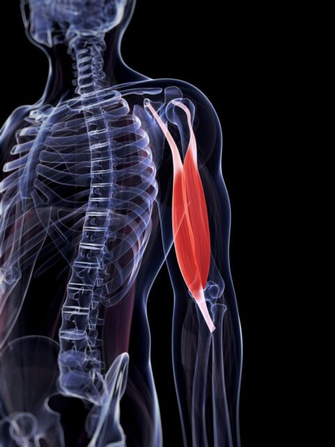 Bicep Tendon Rupture, Bicep Tendon Tear - Rothman Orthopaedics