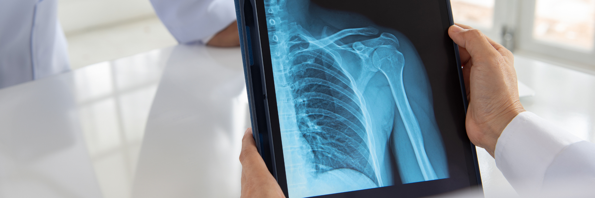 Optimizing Rotator Cuff Repair with Biceps Tendon Transfer - Rothman ...