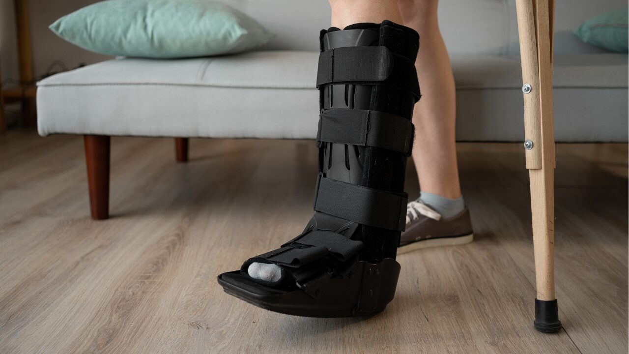 Achilles Tendon Rupture Surgery - Rothman Orthopaedics